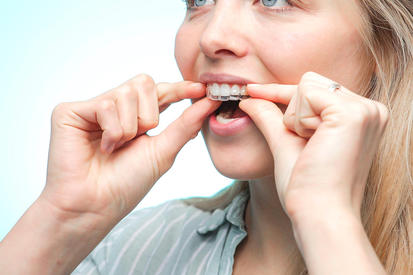 AirSmile | Diasteem verhelpen met AirSmile® - AirSmile